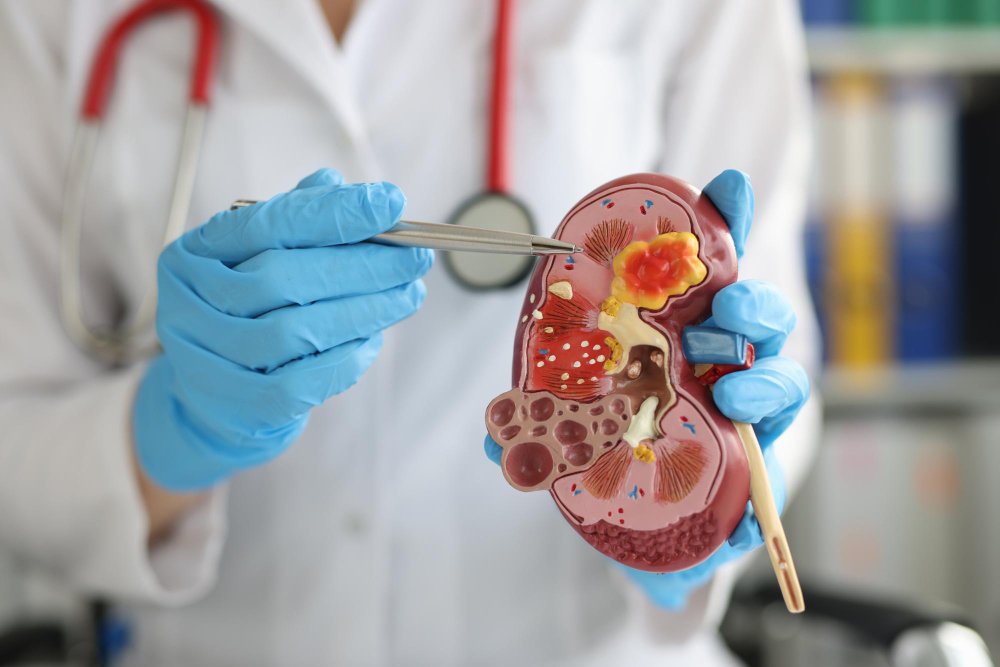 Comprendre les Pathologies Urologiques - Dr Chambade urologue dijon